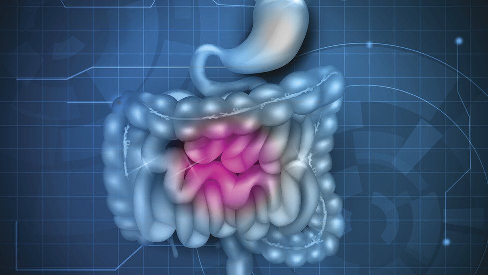 #PooWatch: How your body reacts to not pooing for 20 days - BBC News