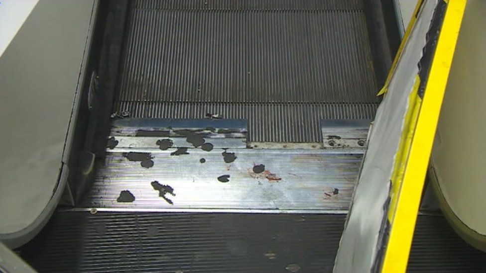 Escalator toe rip man 'still suffering' - BBC News