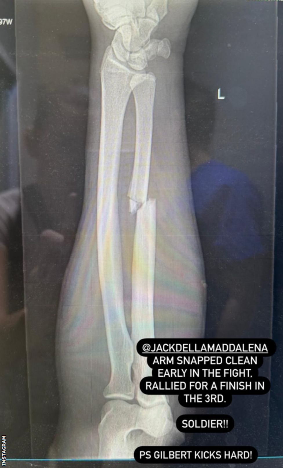 UFC 299: Jack Della Maddalena beat Gilbert Burns with 'snapped' arm ...