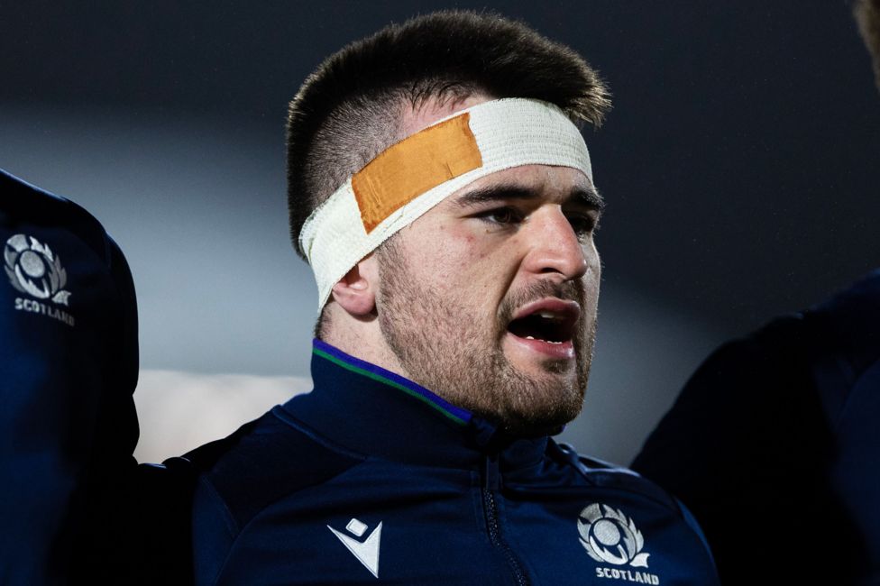 First start for Blyth-Lafferty as Scotland U20 host England - BBC Sport