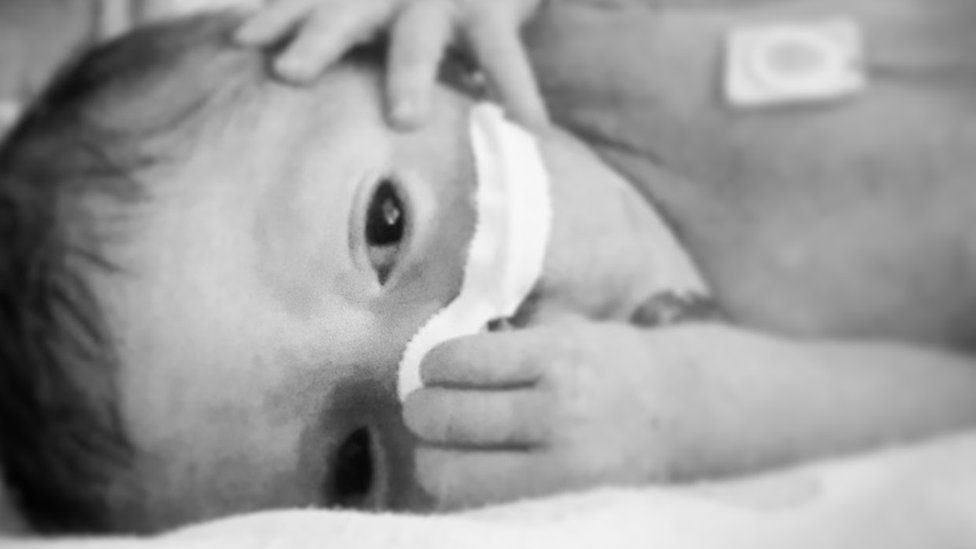 Spina bifida: Parents hope surgery in womb will help son walk - BBC News