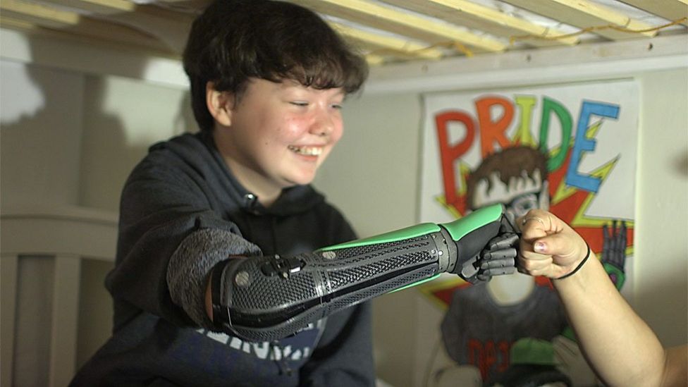 Swavesey boy, 7, leads fundraising campaign for Hero Arm - BBC News