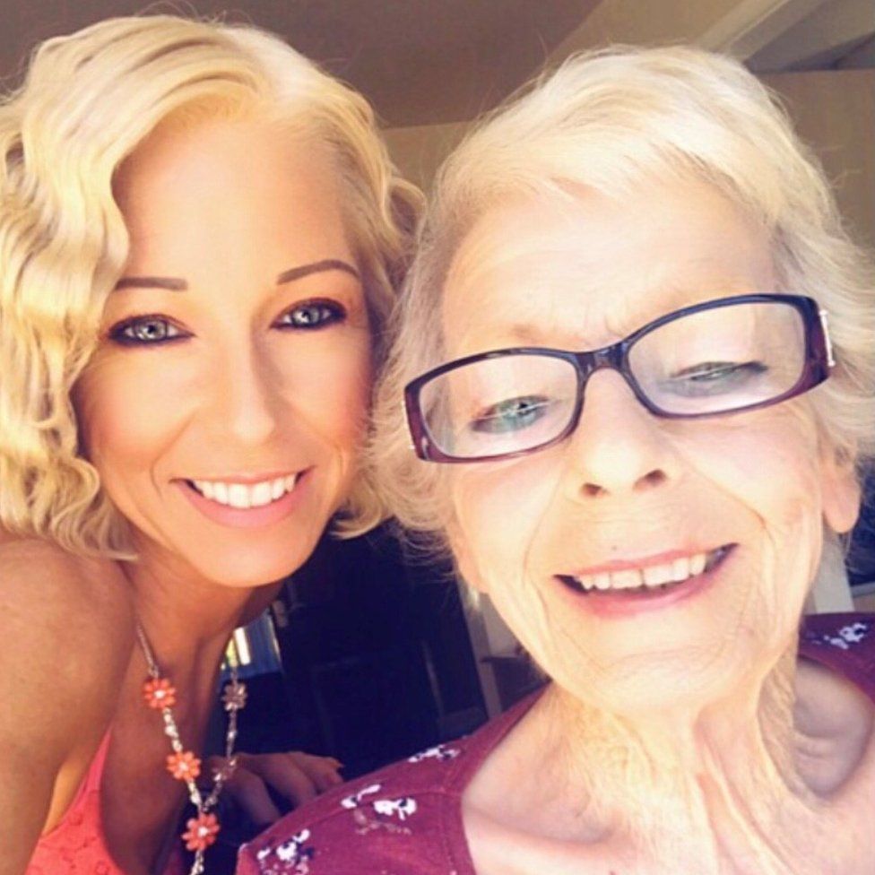 Nottingham double amputee 'died from pressure sores' - BBC News