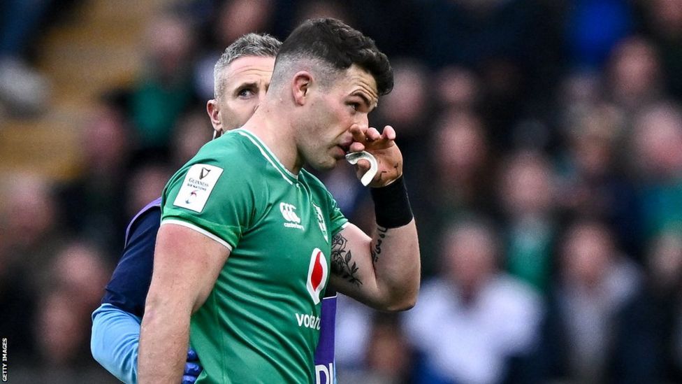 Six Nations 2024: 'Trust the experts' - Andy Farrell backs head injury ...