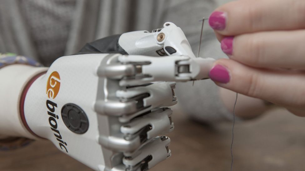 How easy is it for the limbless to get a bionic arm or leg? - BBC News
