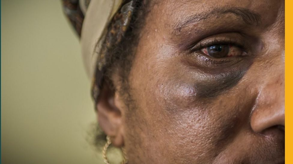 The women publicly tortured after being accused of sorcery - BBC News