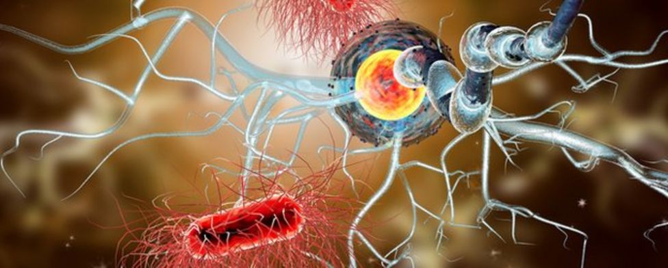 New treatment can 'halt' multiple sclerosis, says study - BBC News