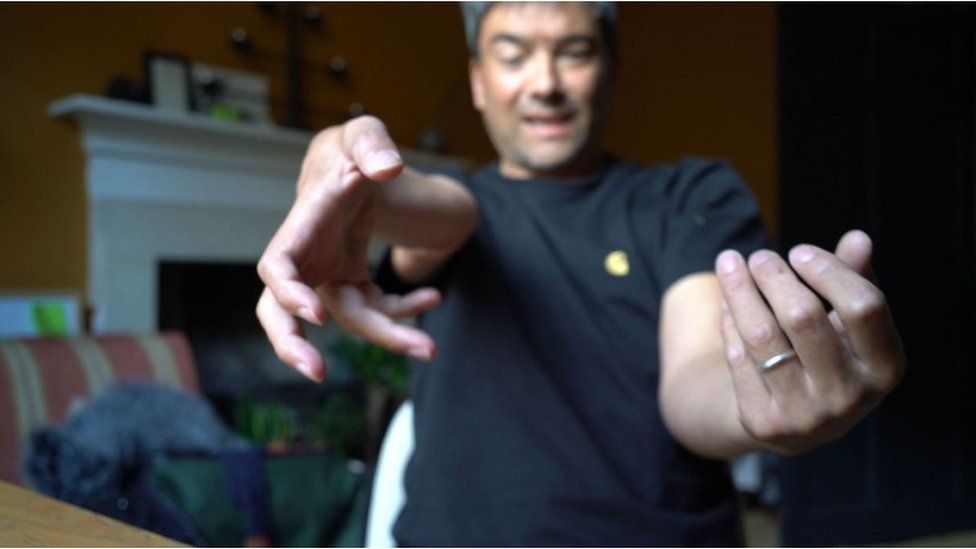 'The rare condition slowly paralysing my arms and legs' - BBC News