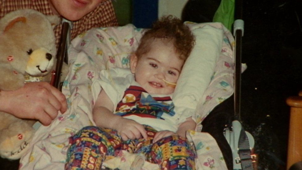 Woman meets surgeon who saved her life with pioneering operation - BBC News