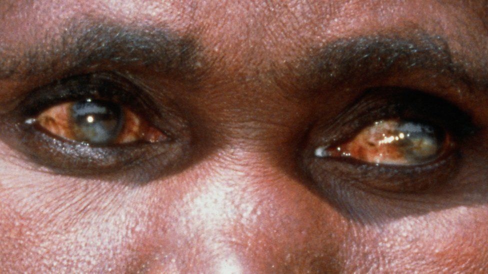 Work that won Nobel Prize for medicine 2015 - BBC News