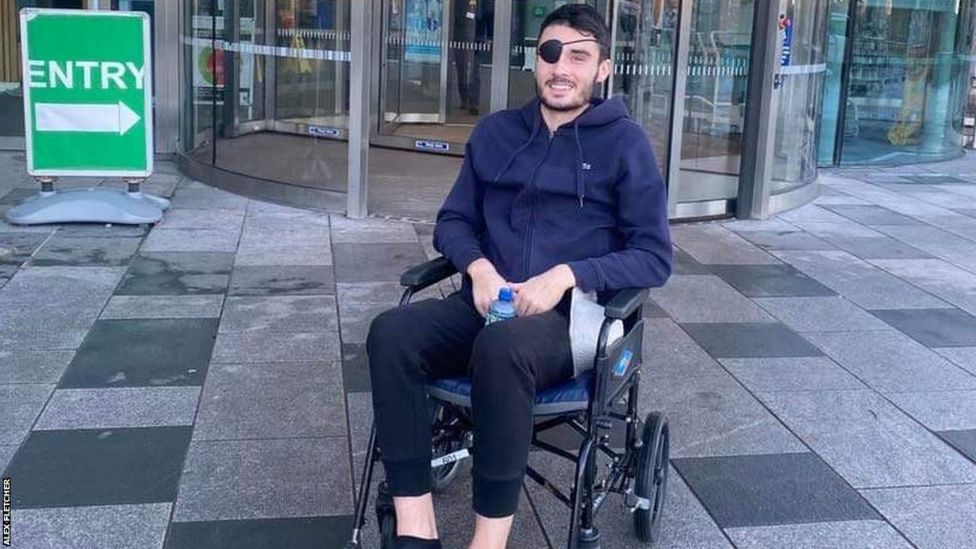 Alex Fletcher: Bath City striker on impact of life-threatening skull ...