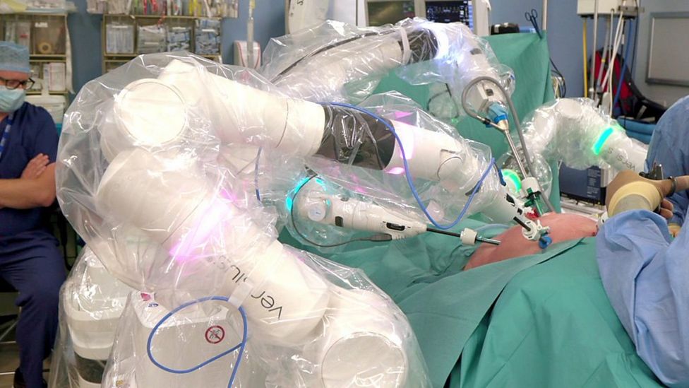 Surgery robots at Bedfordshire hospitals look to help patient recovery ...
