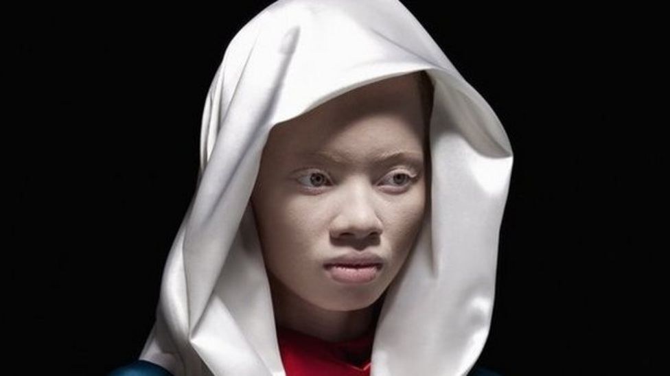 People with albinism in Malawi face 'total extinction' - UN - BBC News