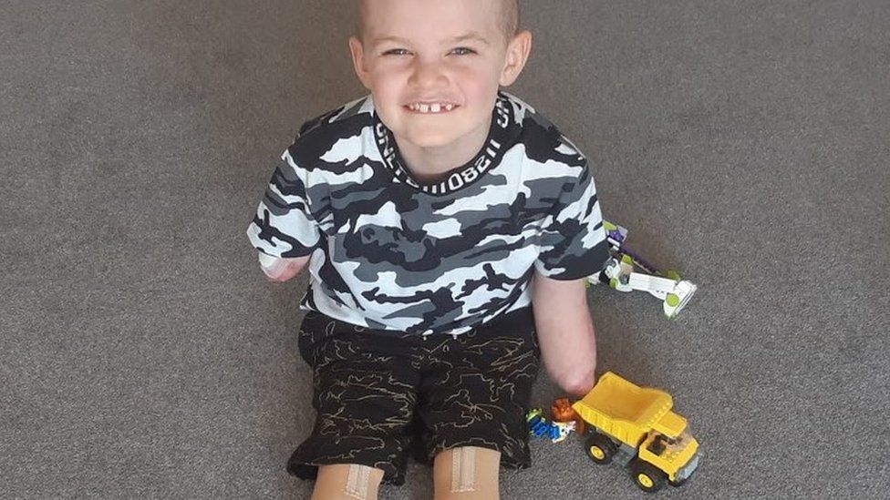 Luke Mortimer: Aim to give Skipton boy who lost limbs 'best life' - BBC ...