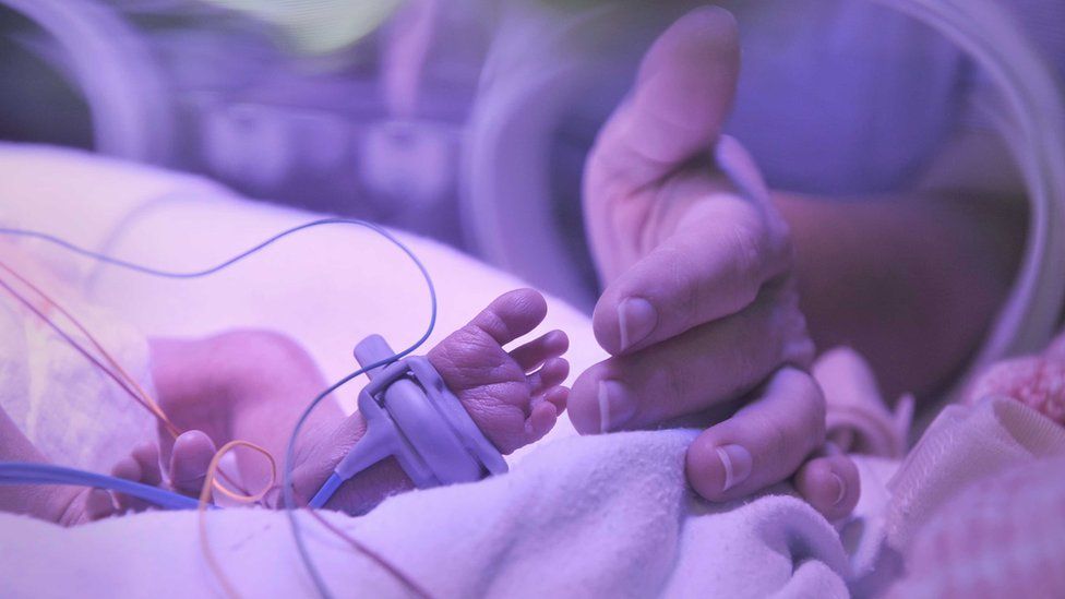 Baby deaths: MPs tell of pain and trauma of their loss - BBC News