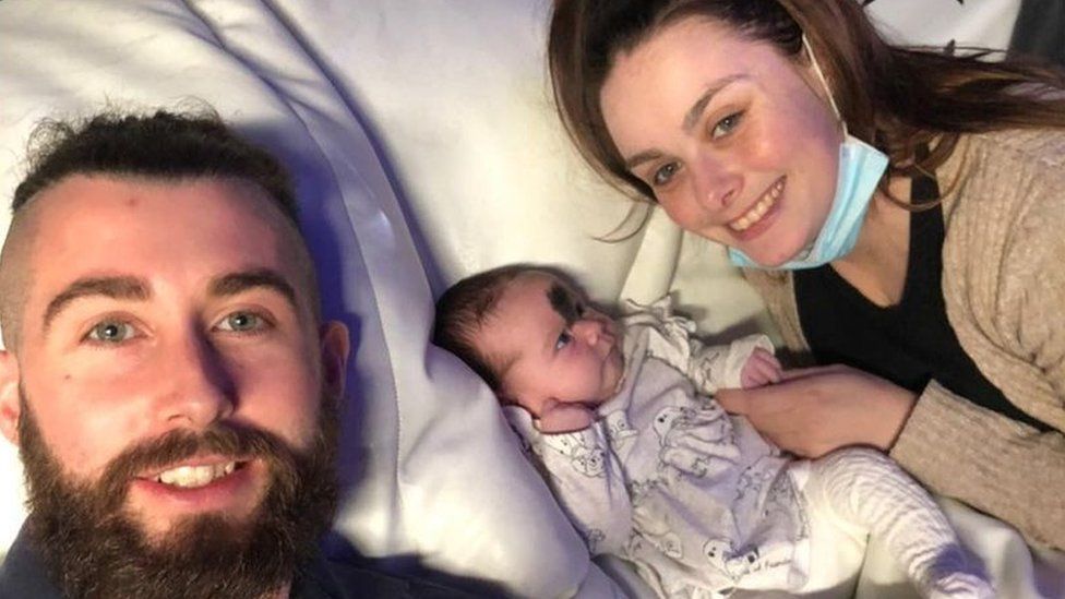 Baby's birthmark surgery fund raises £25,000 - BBC News