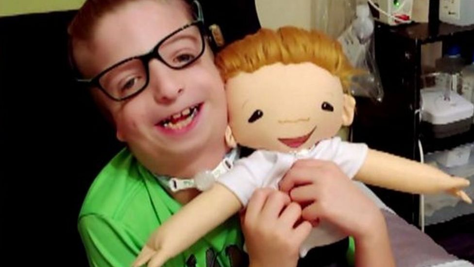 Dolls made with cleft lips and heart surgery scars - BBC News