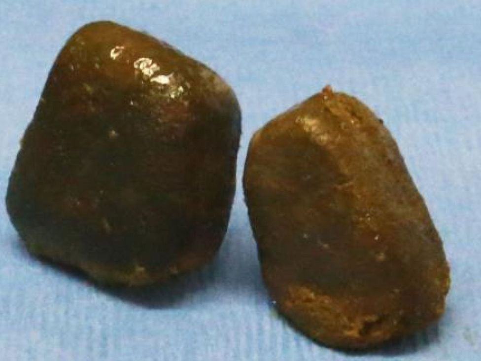Wombats discovered to have cube-shaped poo - BBC Newsround