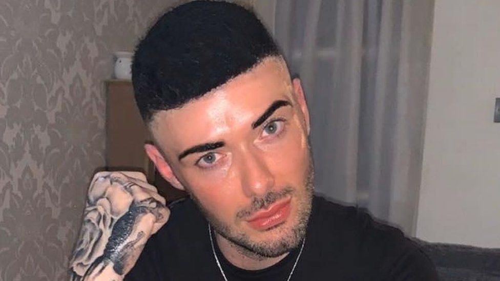 Botox: Plant yn dod o Loegr i Gymru i dderbyn triniaeth - BBC Cymru Fyw