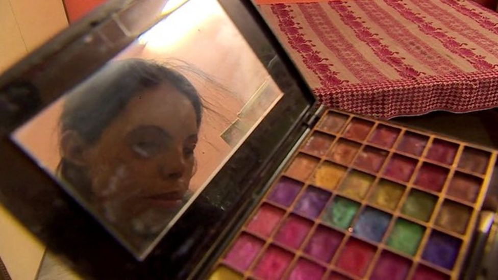 The UK team whose holidays give acid attack victims new hope - BBC News