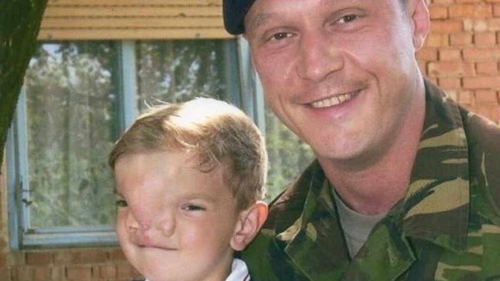 Ex-soldier Wayne Ingram walks 70 miles backwards for spinal charity ...