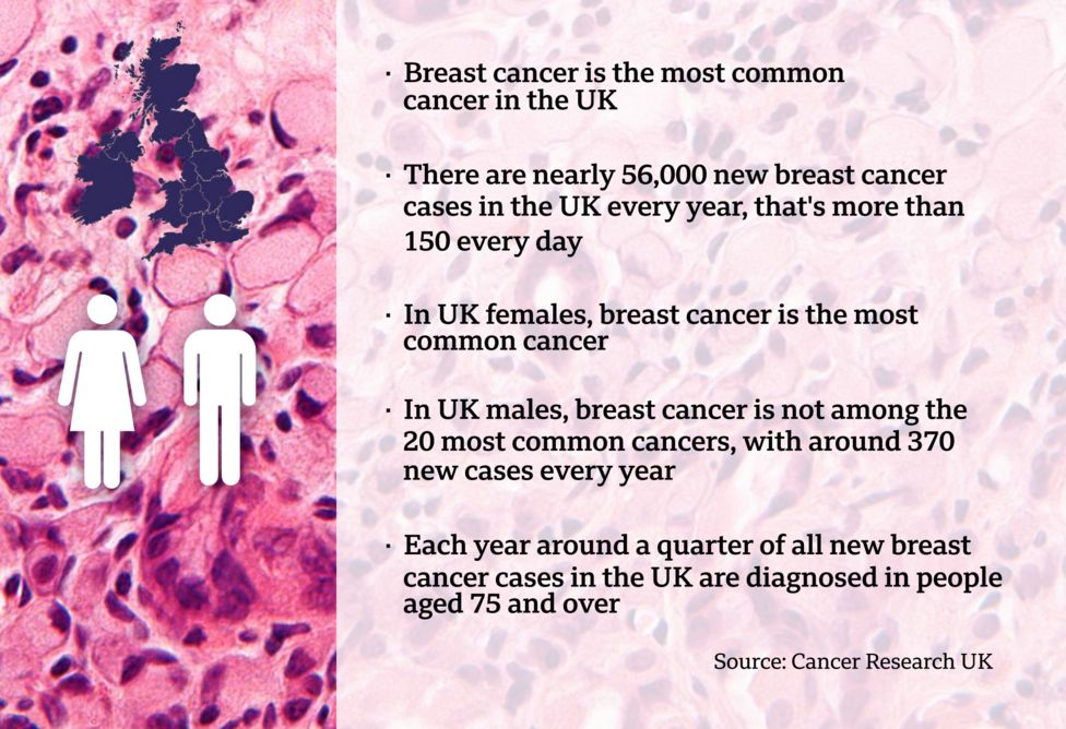 Breast cancer: 'Many men are oblivious they can get breast cancer ...