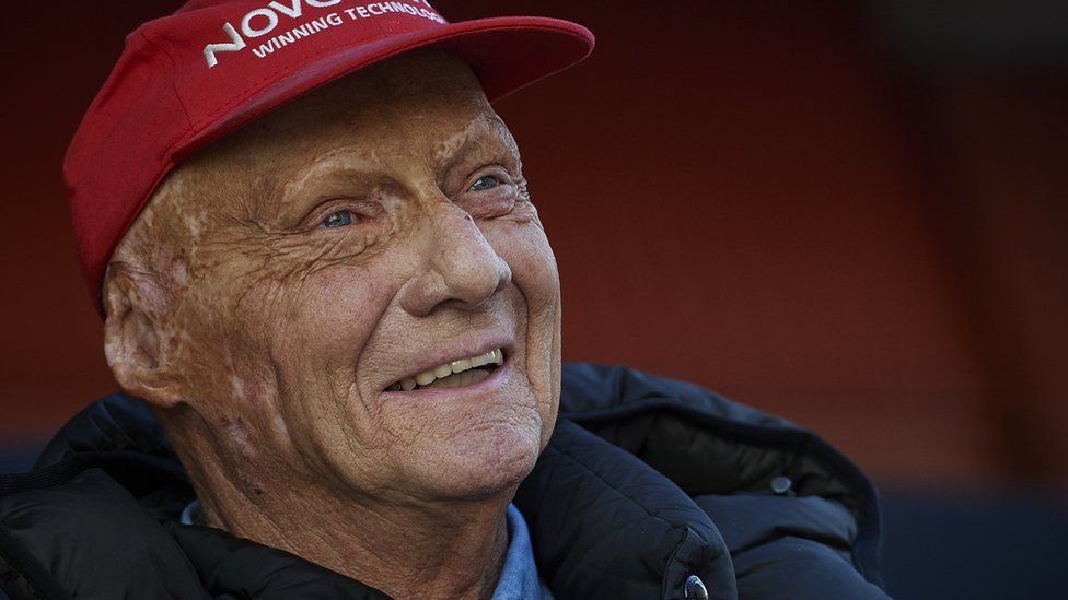 Niki Lauda Ears