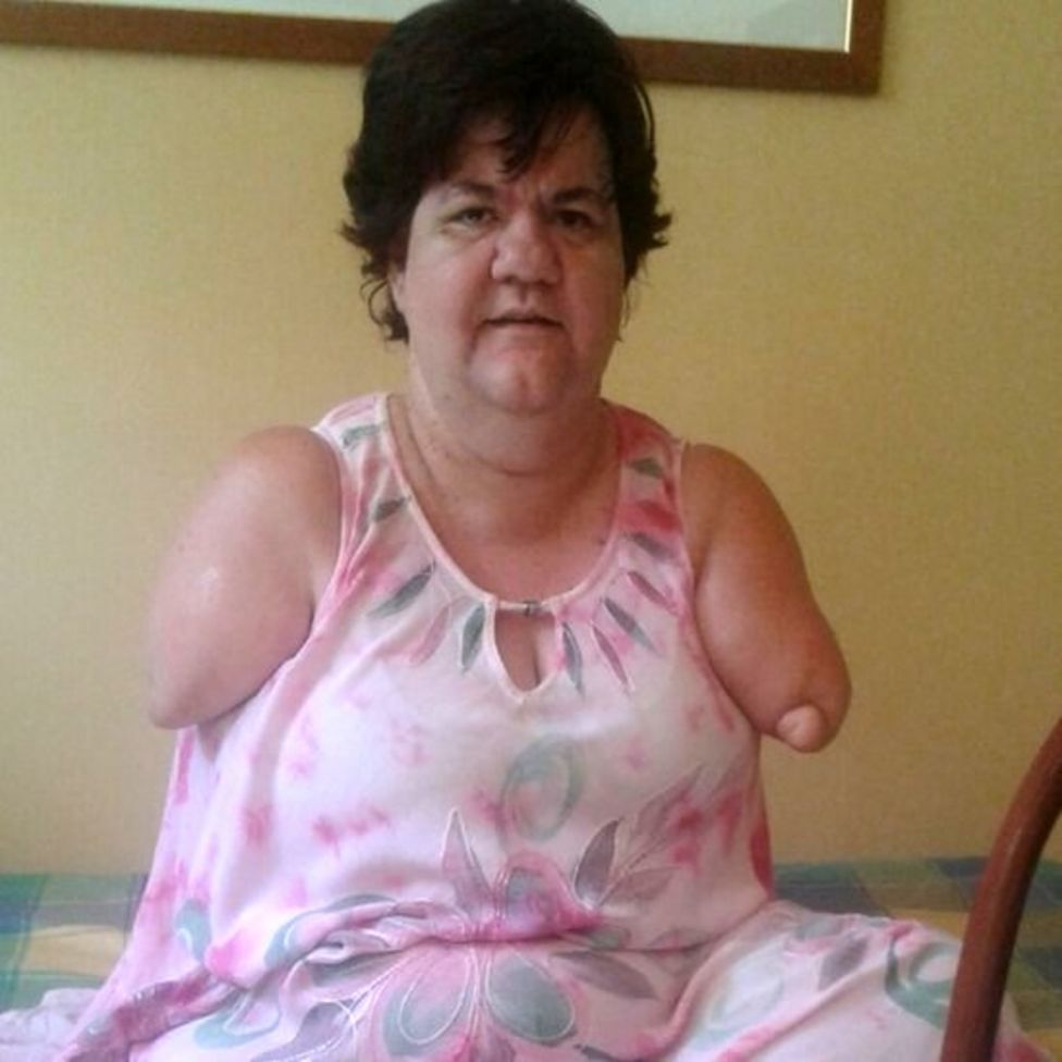 Spain's forgotten Thalidomide victims see glimmer of hope - BBC News