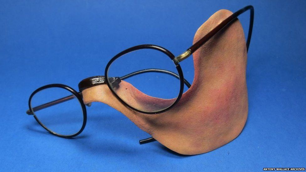 Leeds display explores sculptors' role in prosthetics development - BBC ...
