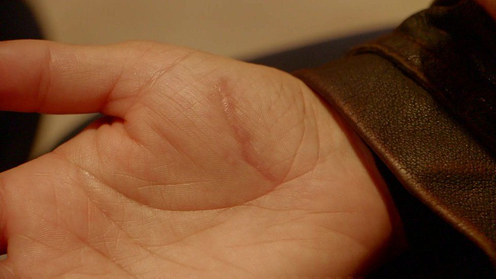 The children who hit their parents - BBC News