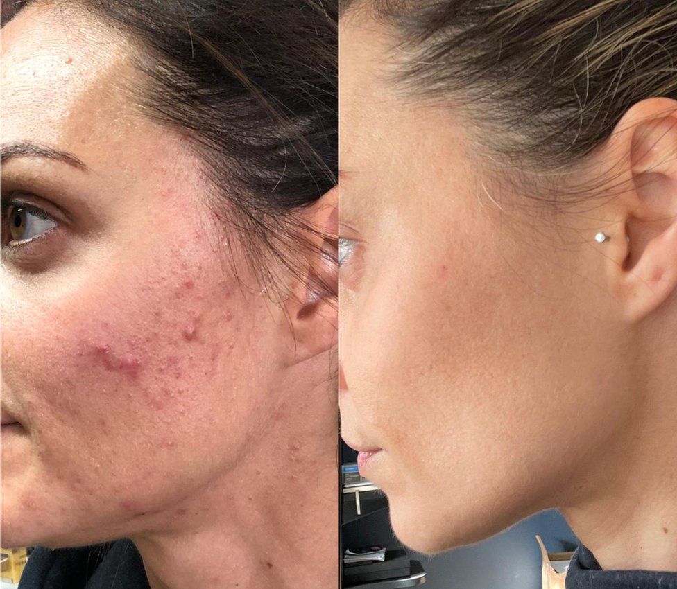 Traddodiad teuluol yn ysbrydoli cynnyrch croen newydd - BBC Cymru Fyw