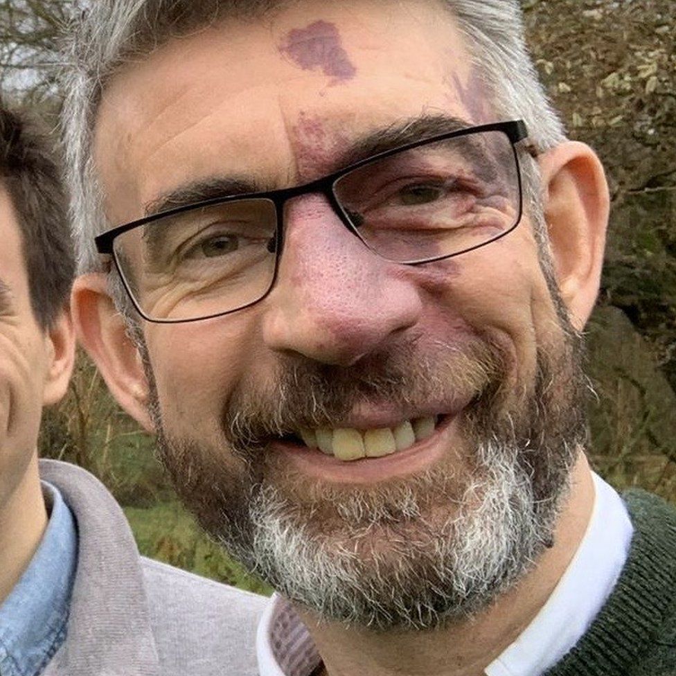 Richard Morris: Appeal to joggers over missing UK diplomat - BBC News