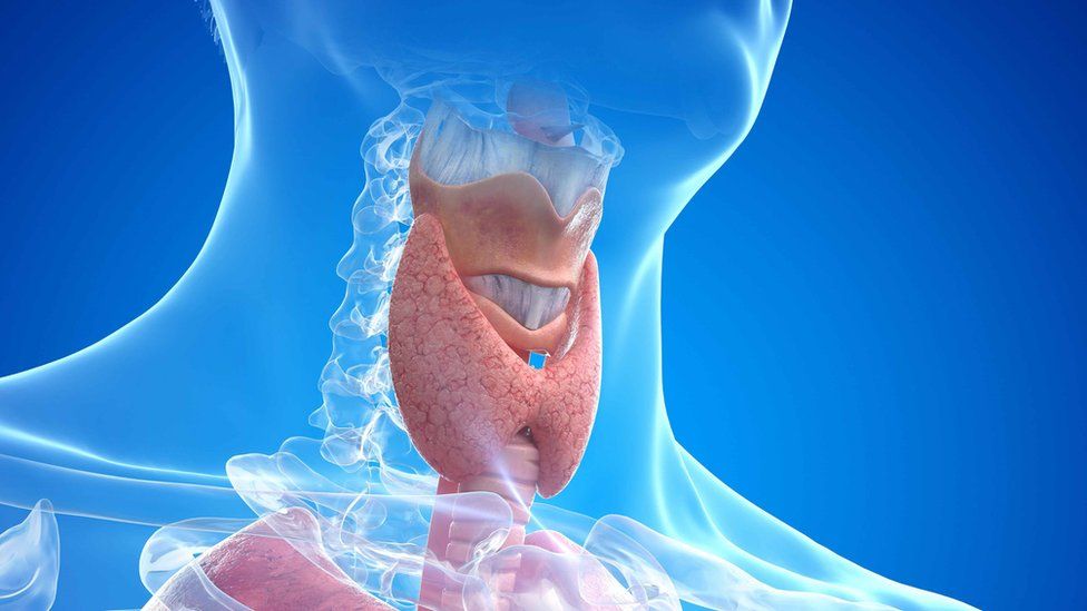 Thyroid: Gormod yn 'anwybyddu' symptomau salwch 'anweledig' - BBC Cymru Fyw