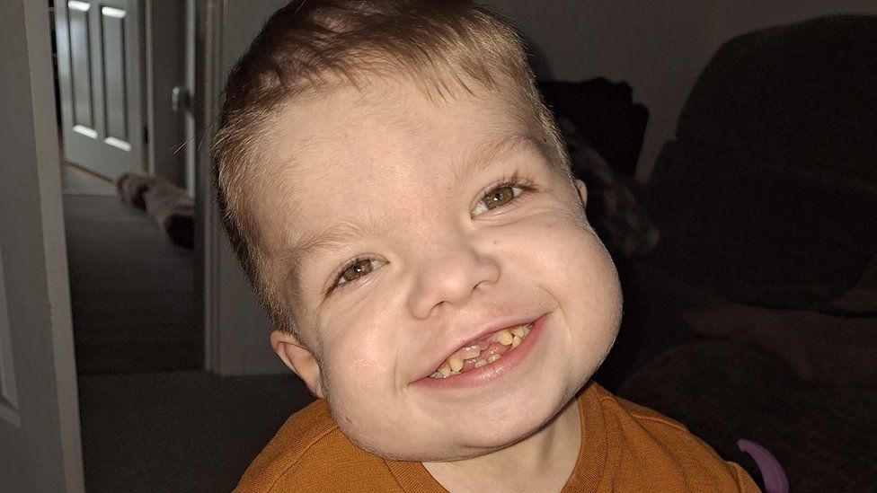 Oswaldtwistle boy, 7, recovering after kidney transplant from dad - BBC ...