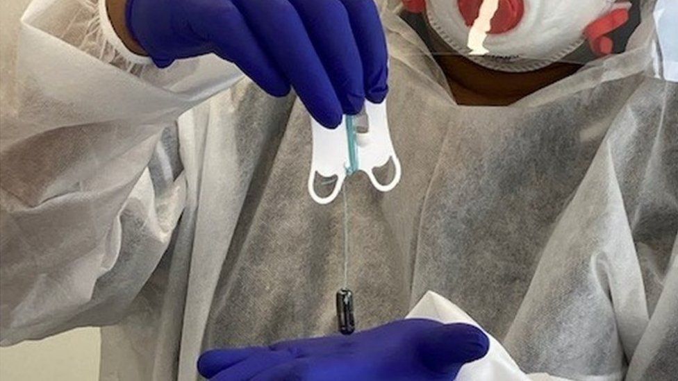 Scotland first to use 'sponge on a string' pill as cancer test - BBC News