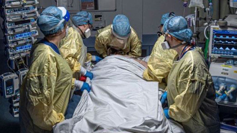Covid: NHS nurse photographs ‘realities’ of ICU ward - BBC News