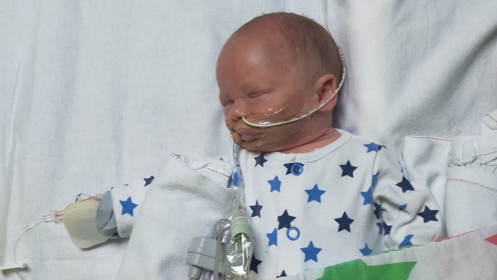 Coronavirus: Parents of Covid-19 positive baby cannot see son - BBC News