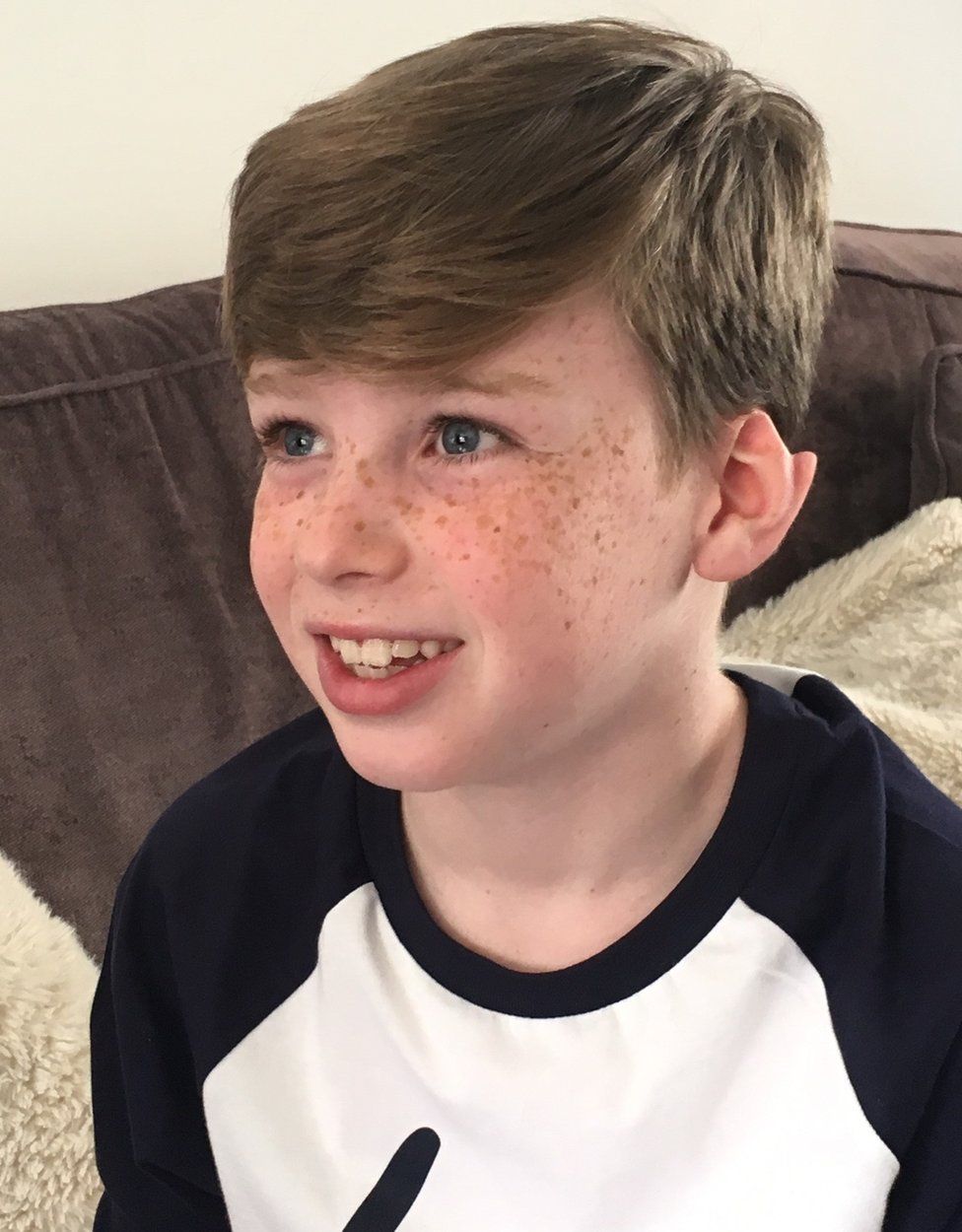 My son was scarred for life by dangerous dog - BBC News