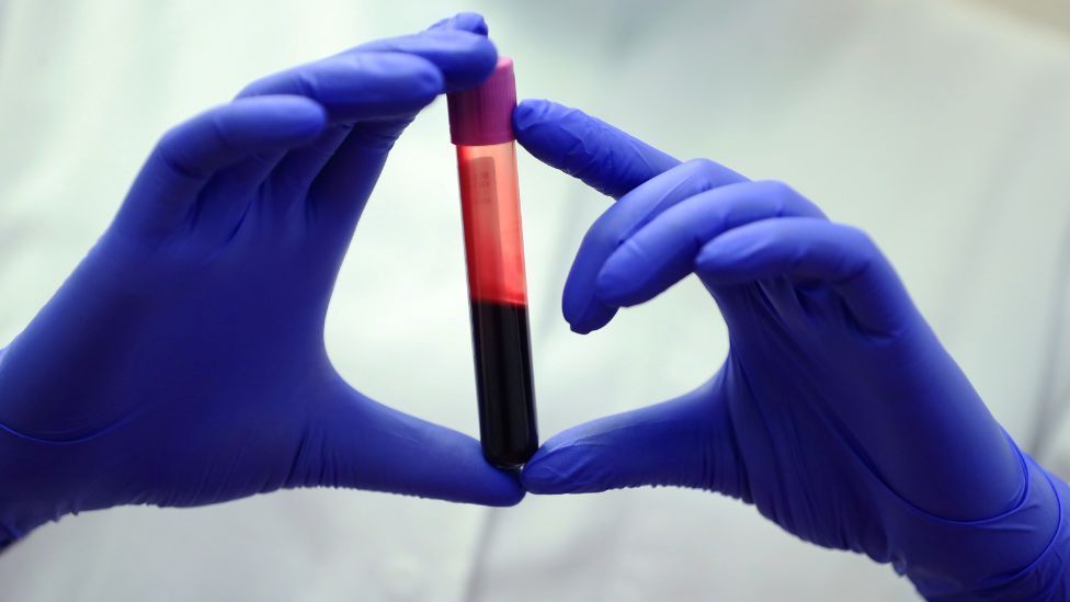 Scottish infected blood victims 'studied without their knowledge' - BBC ...