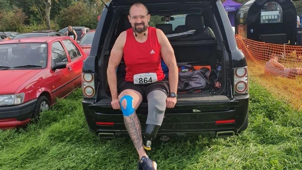 Derbyshire man who asked for leg amputation takes on 10km run - BBC News