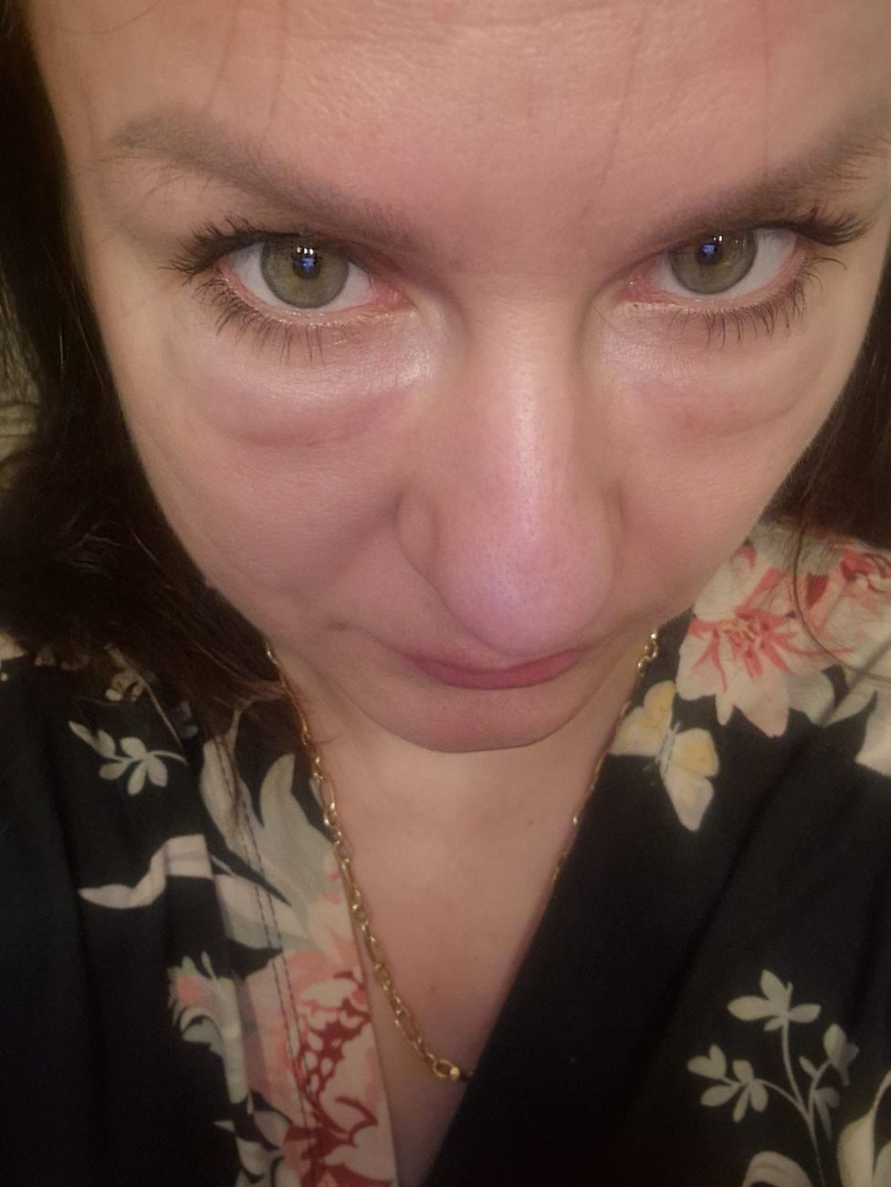 Scotland ‘worst in Europe’ for unregulated fillers - BBC News