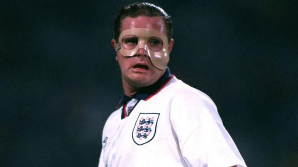 Kylian Mbappe: 11 iconic images of great players in masks - BBC Sport