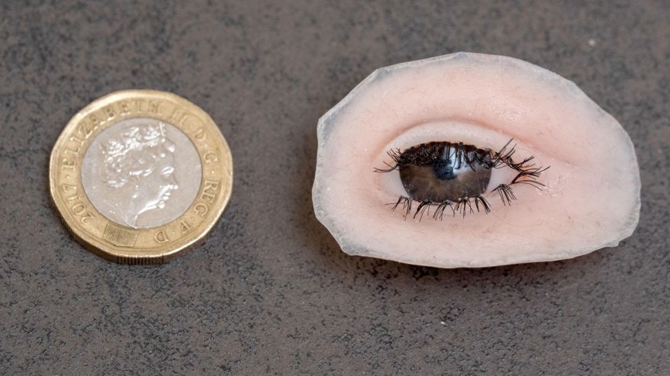 Alder Hey: Baby girl given new prosthetic eye after rare cancer - BBC News
