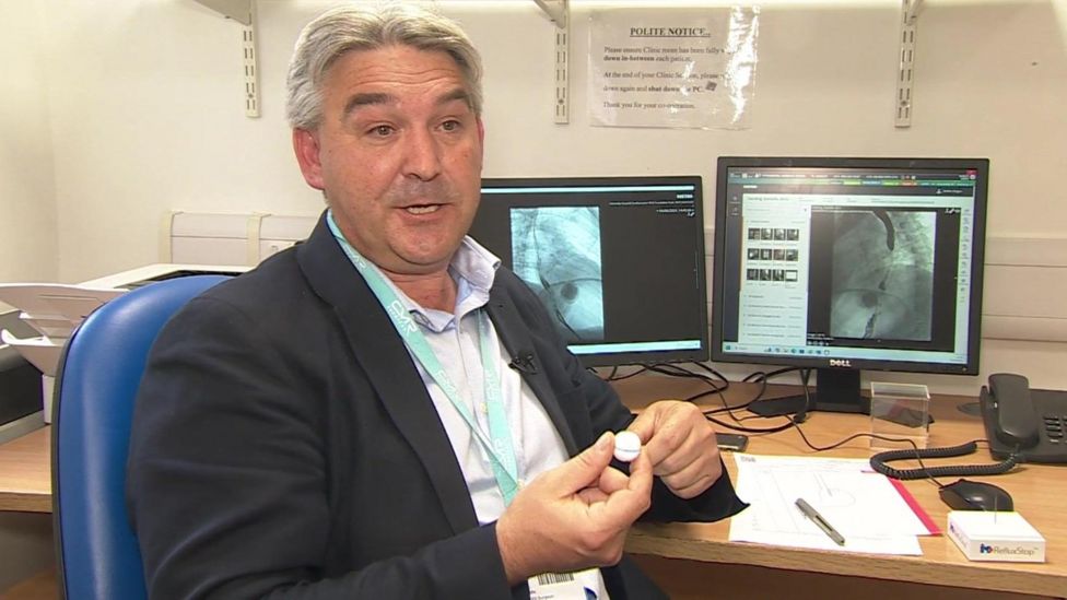 Patient hails 'life-changing' implant for severe acid reflux - BBC News