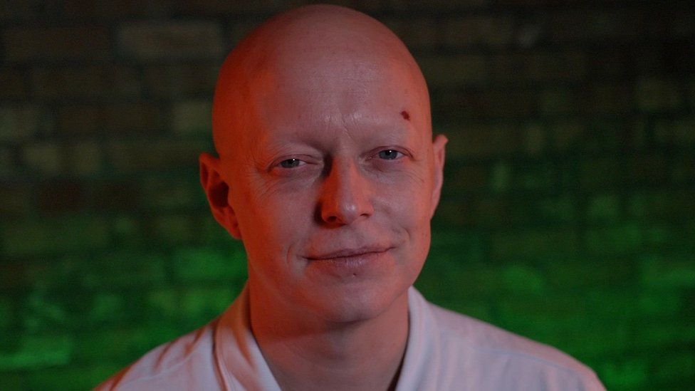 Alopesia: 'Mynd i'r afael â'r her o fyw bywyd yn foel' - BBC Cymru Fyw