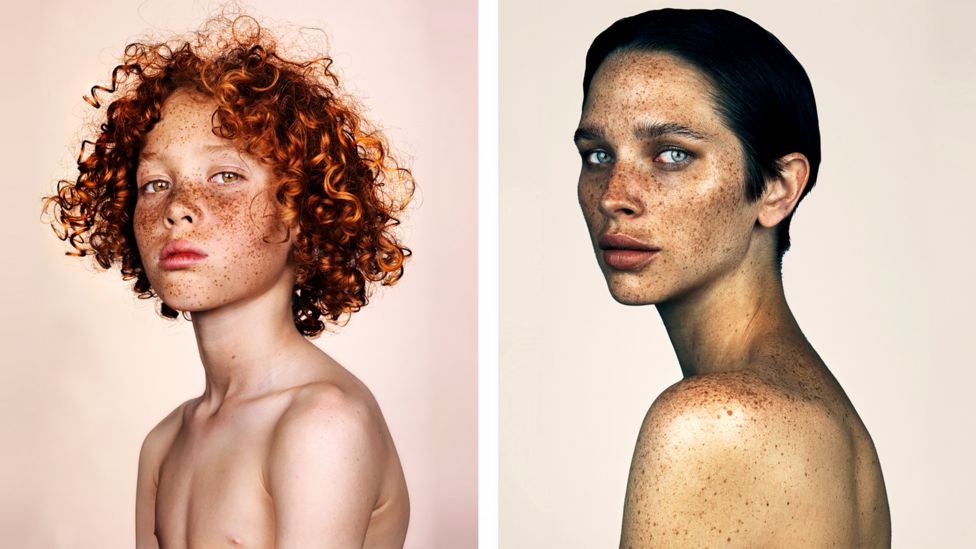 These photos will make you love your freckles - BBC Three