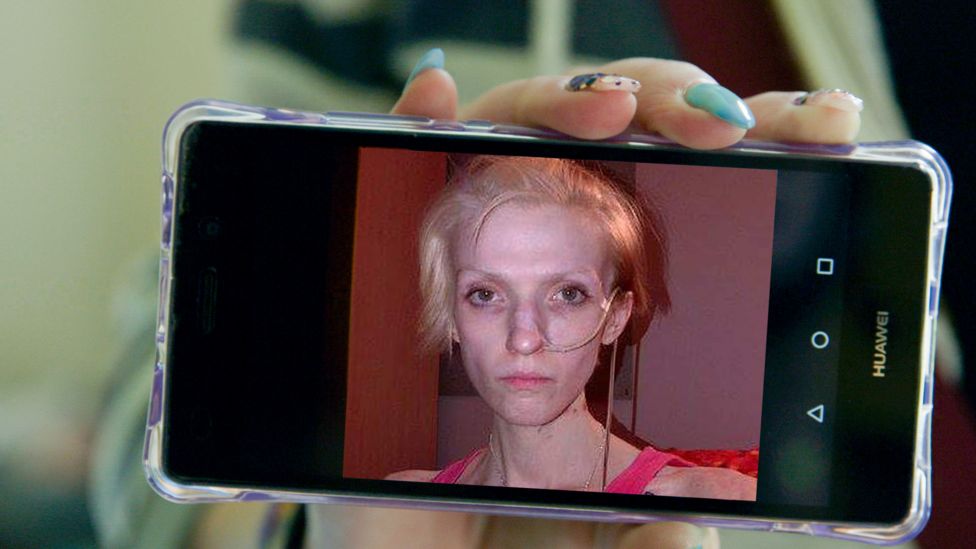 Living with diabulimia, the world’s most dangerous eating disorder ...