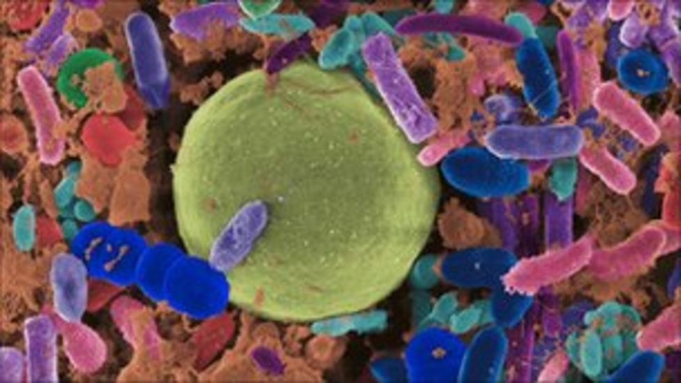 Cumbernauld pools closed over diarrhoea bug - BBC News