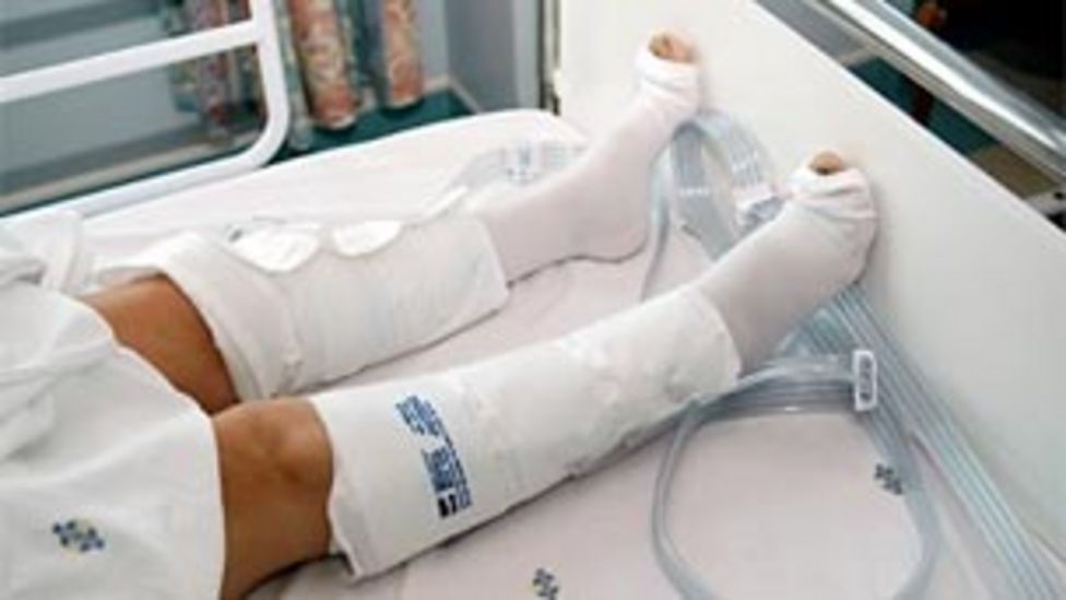 Antipsychotic drugs 'appear to raise blood clot risk' - BBC News