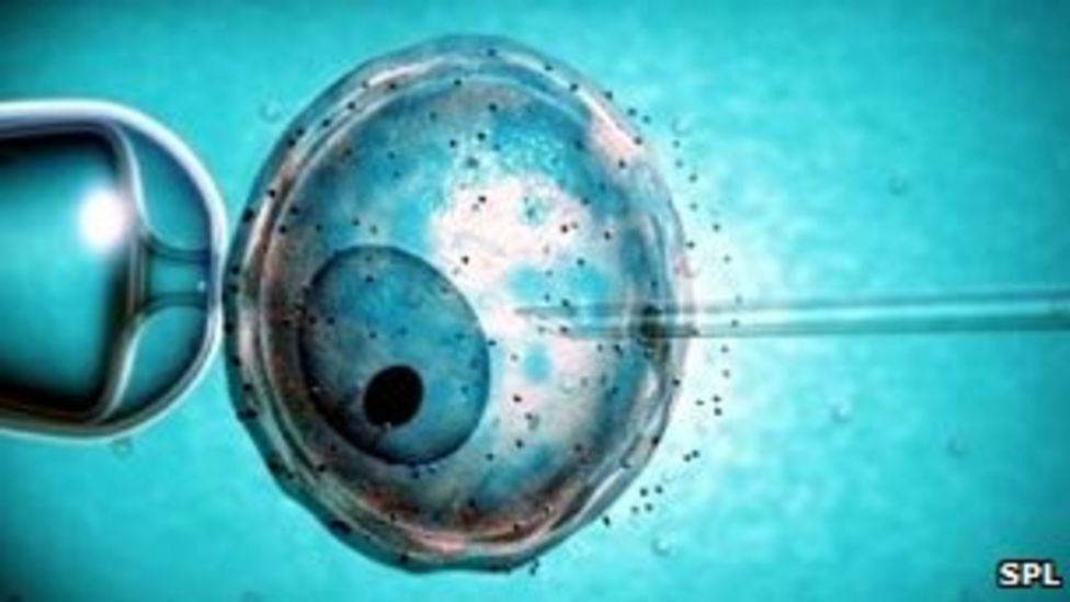 The birth of IVF - BBC News